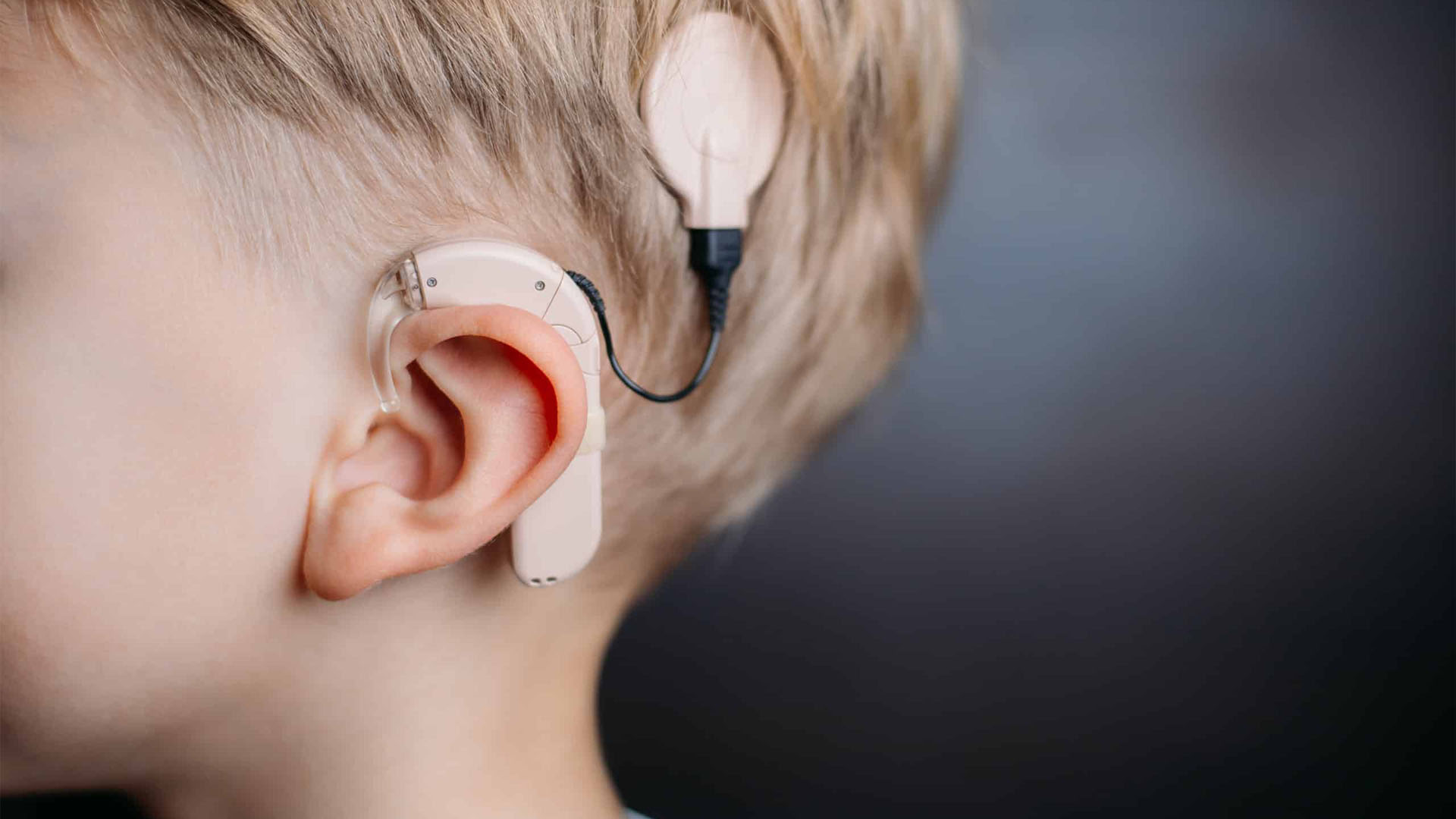 Understanding the Mechanics of Cochlear Implants | nora
